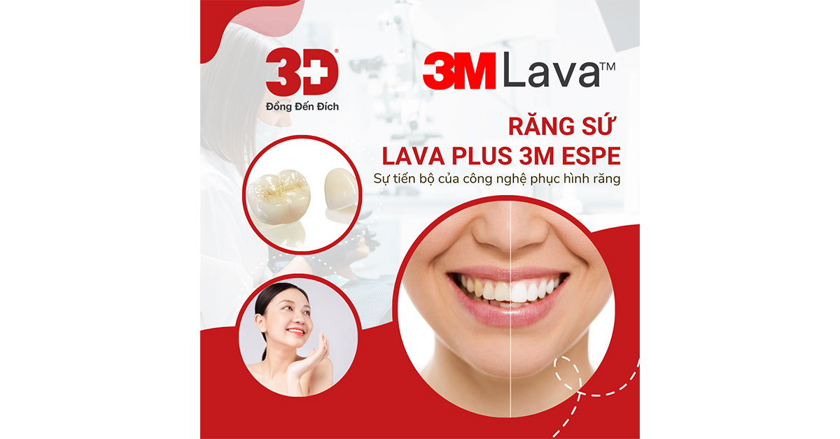 Răng sứ LAVA PLUS 3M: Sự tiến bộ của công nghệ phục hình răng - ĐỒNG ...